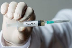 Come si prende il tetano: guida alla profilassi, vaccinazione e cura del tetano